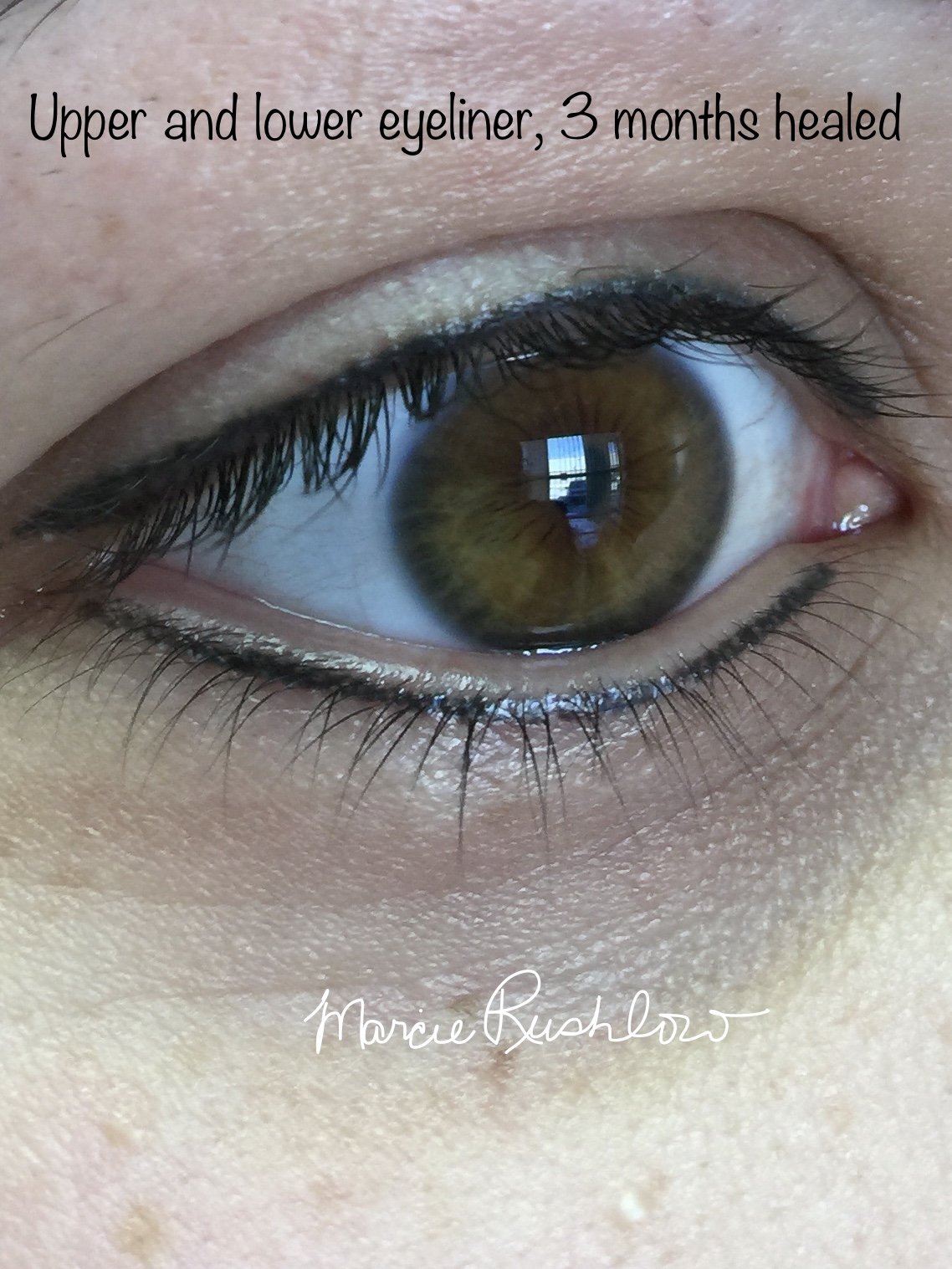 Permanent Eyeliner | Colour Clinic | Oakville, ON