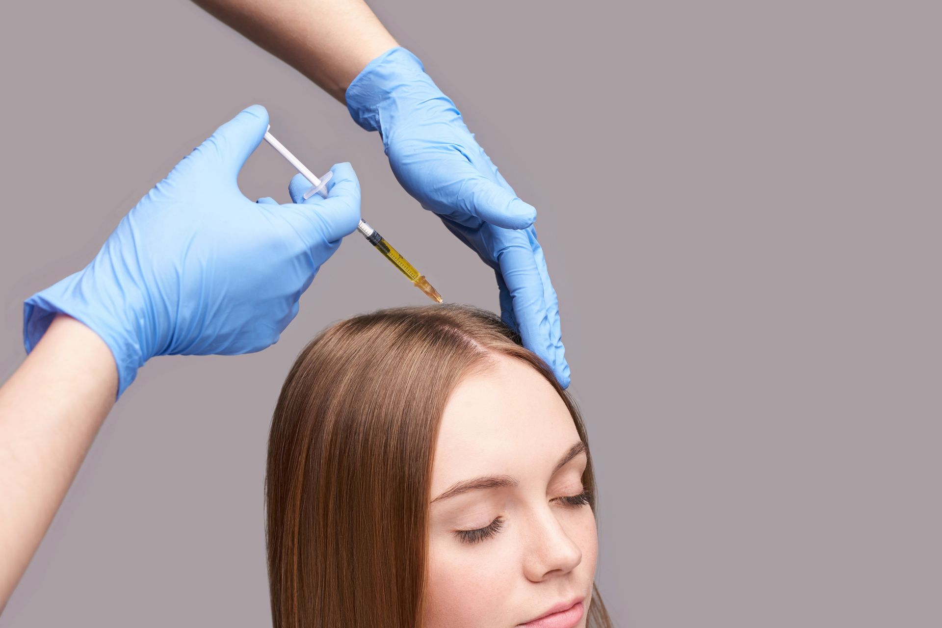 PRP Scalp Therapy in Montgomery Village, MD | Kate Cosmedici Medical Spa