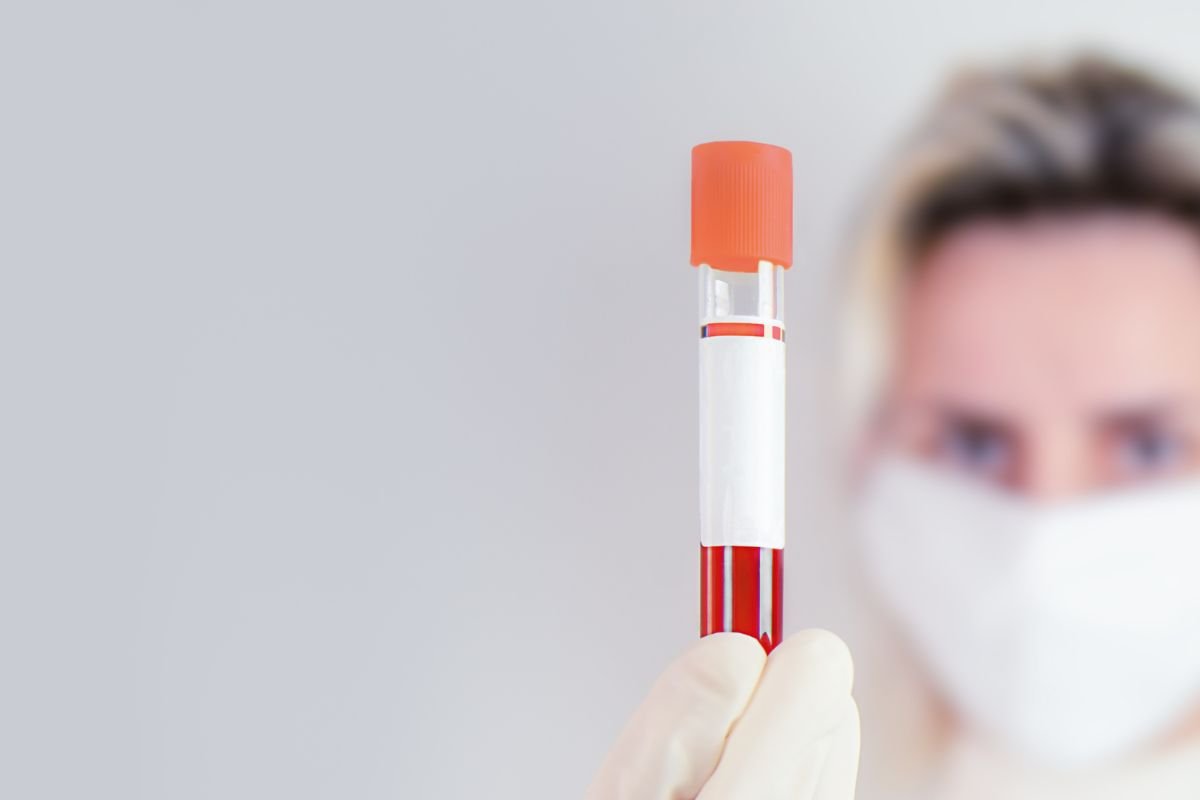 HIV: o que você precisa saber?