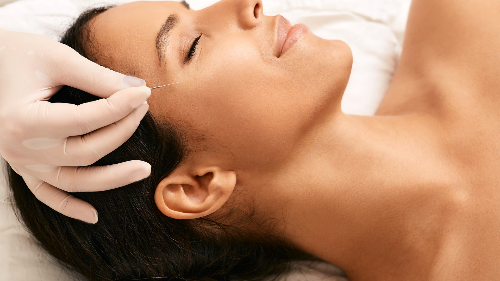 Acupuncture | Madison Lake, MN | AGE Acupuncture LLC