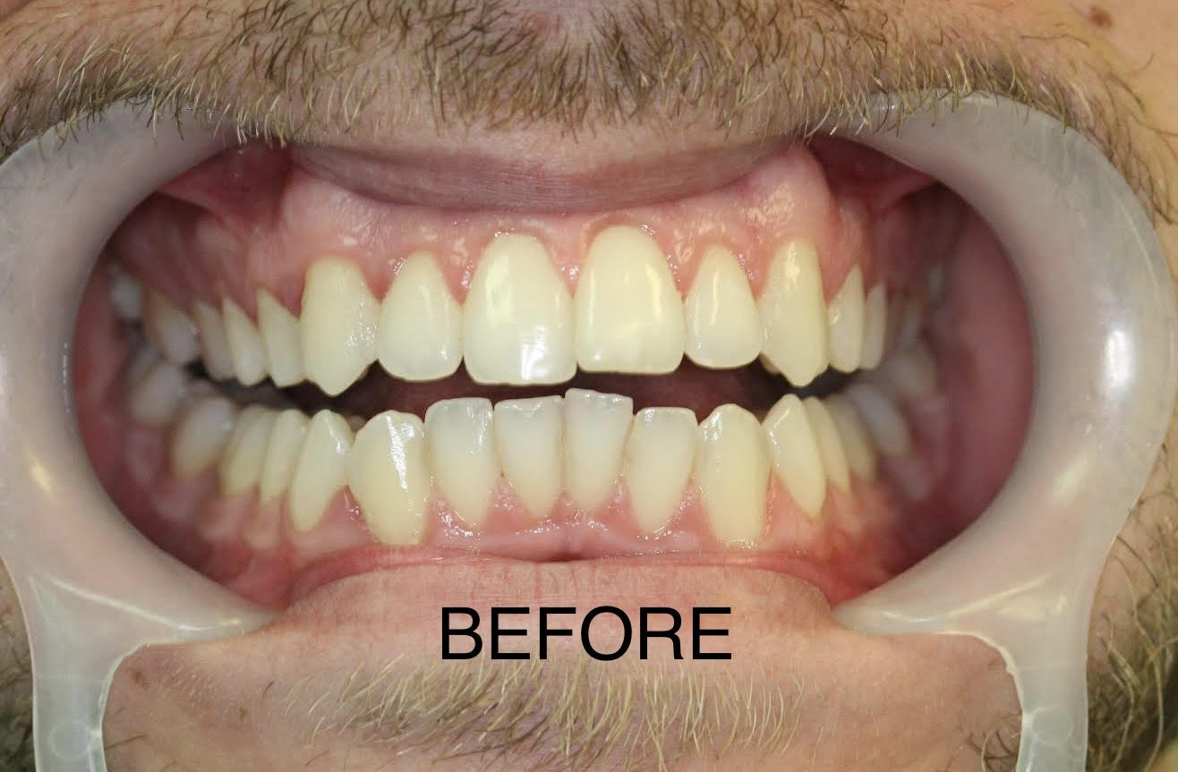 Before & After | Christopher Bernardini D.D.S