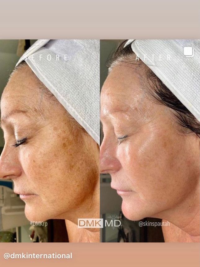 DMK Stemzyme: Jugendliches Strahlen entfalten