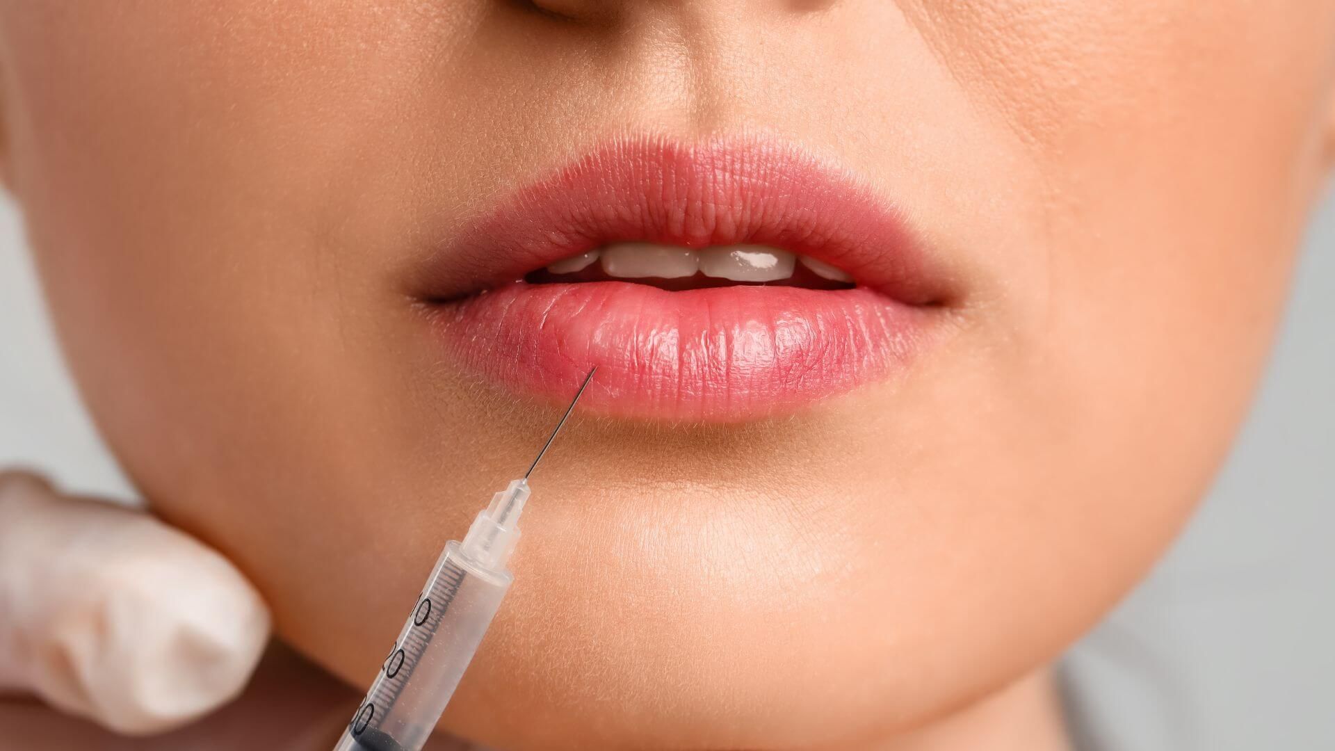 The Complete Guide to Lip Fillers in Rhode Island: What You Need to Know