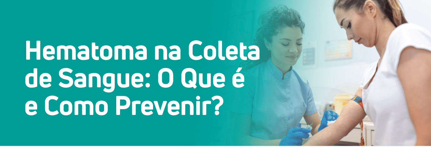 Hematoma na coleta de sangue: o que é e como prevenir?
