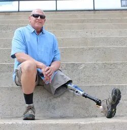 Knee Prosthesis: What You Should Know