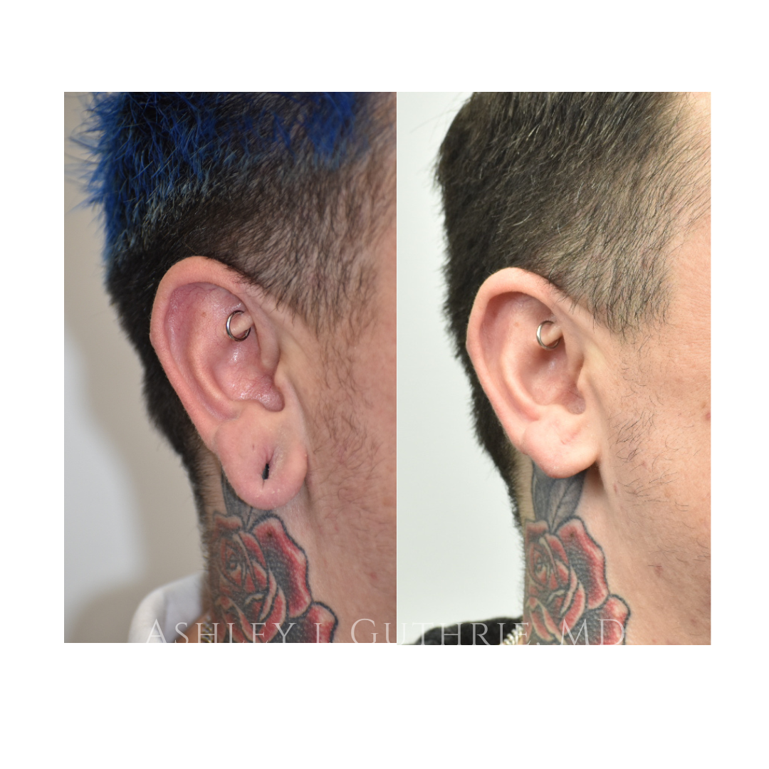 Facial Cosmetic Surgery Gallery | Guthrie Facial Plastic Surgery