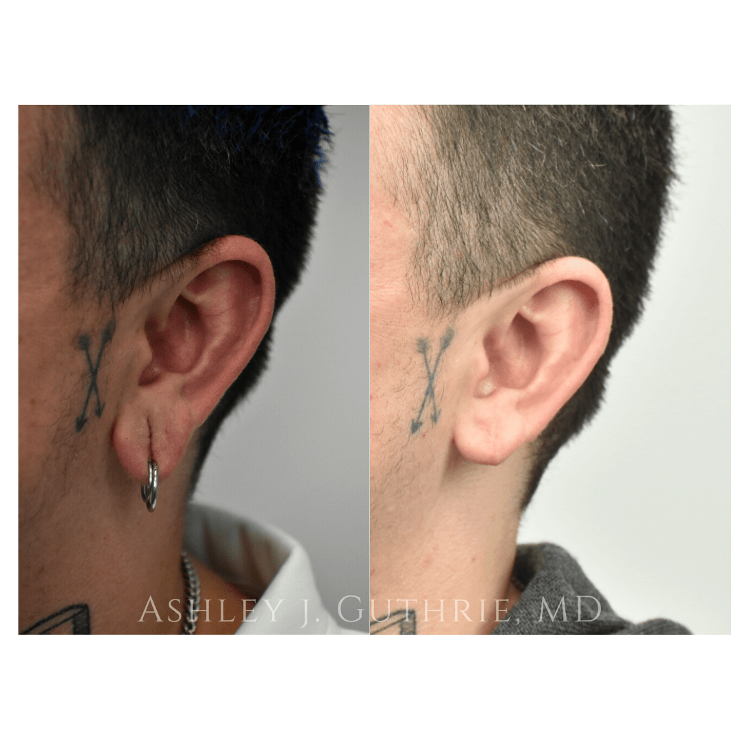 Facial Cosmetic Surgery Gallery | Guthrie Facial Plastic Surgery