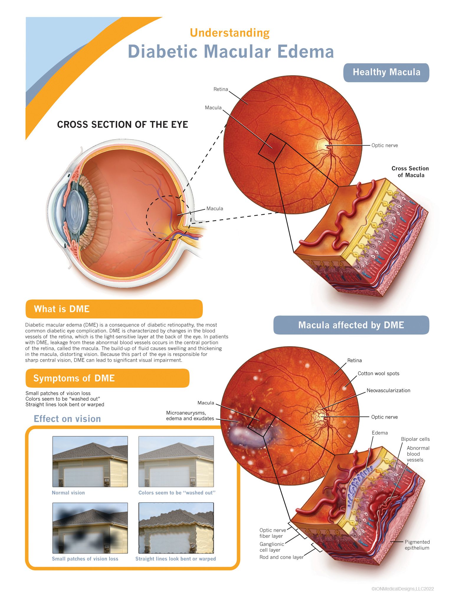 Showcase of Accurate and Visual Medical Illustrations | Ion Medical Designs