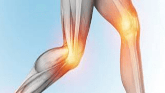 Patellofemoral Pain Syndrome
