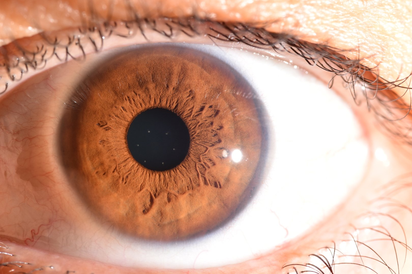 Osservazione iridi | Pescara | Dott.ssa Nicoletta Sgarbi