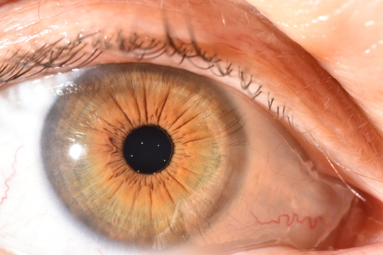 Osservazione iridi | Pescara | Dott.ssa Nicoletta Sgarbi