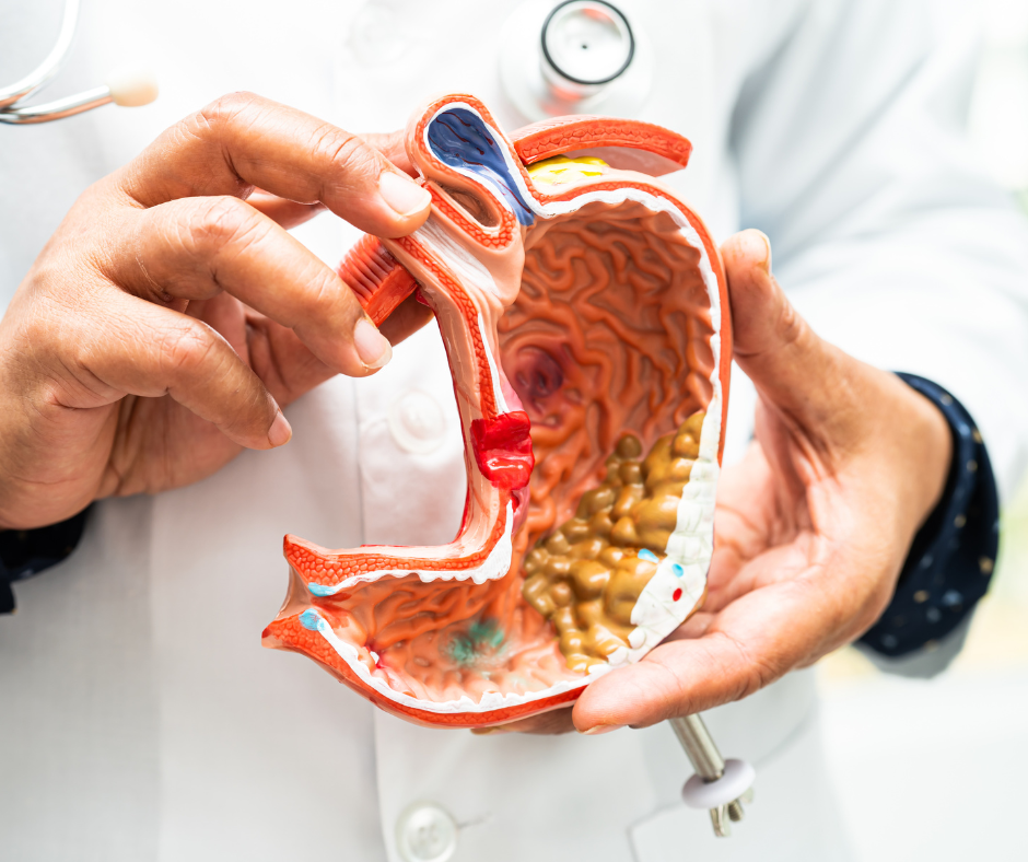 Treatments | Los Angeles Cancer Network