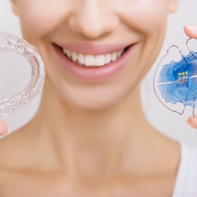 The Importance of Consistently Wearing Retainers for Life