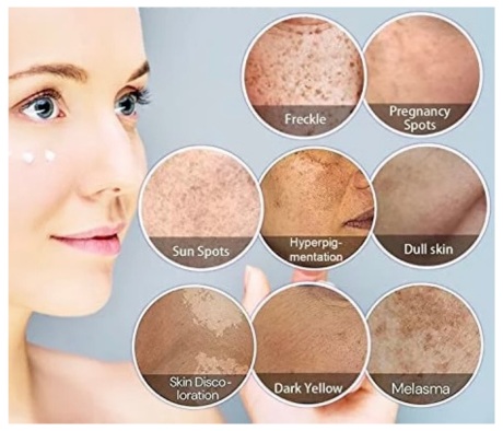 Pigmented Skin Lesions