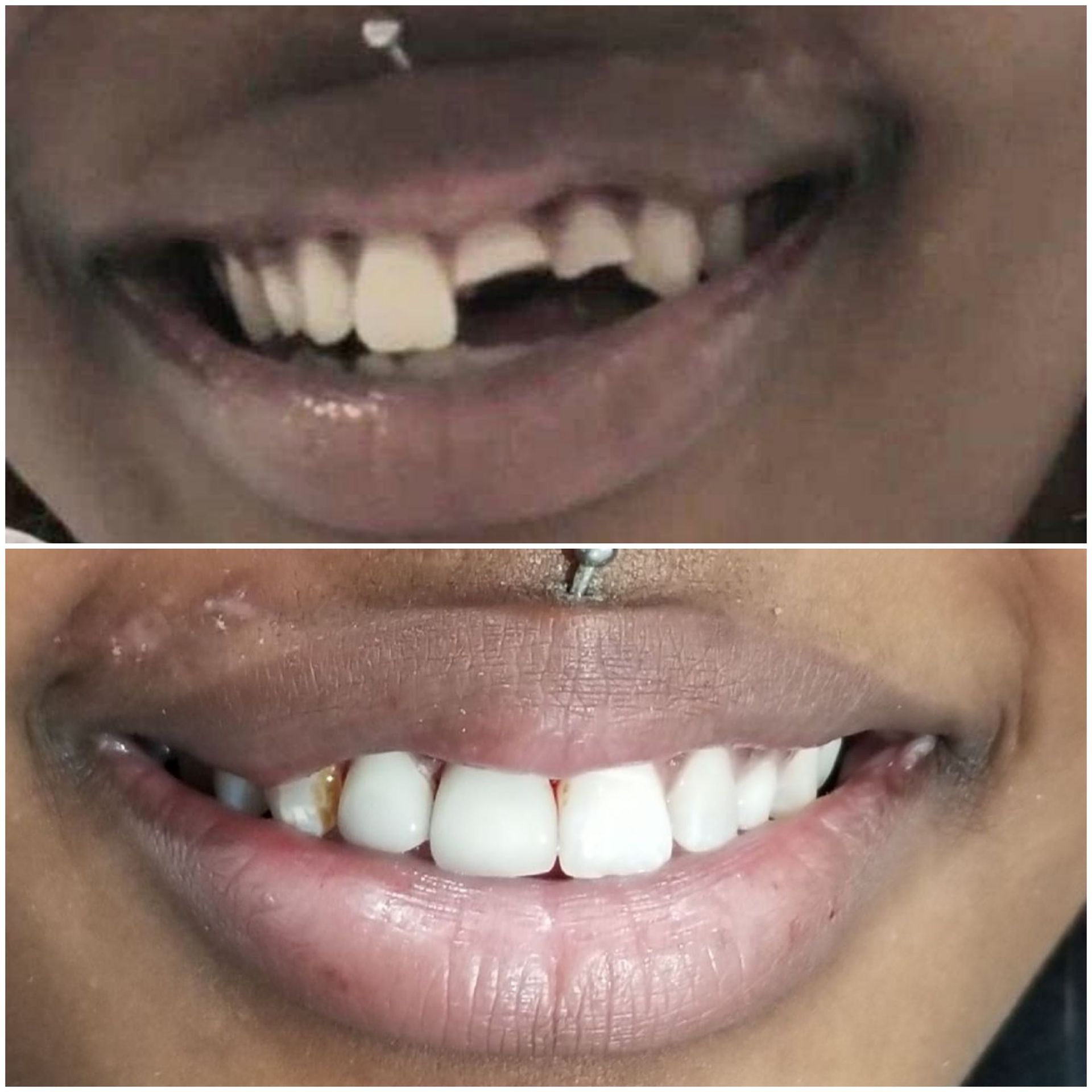 Smiles Gallery | WOW Dental | Detroit, Michigan