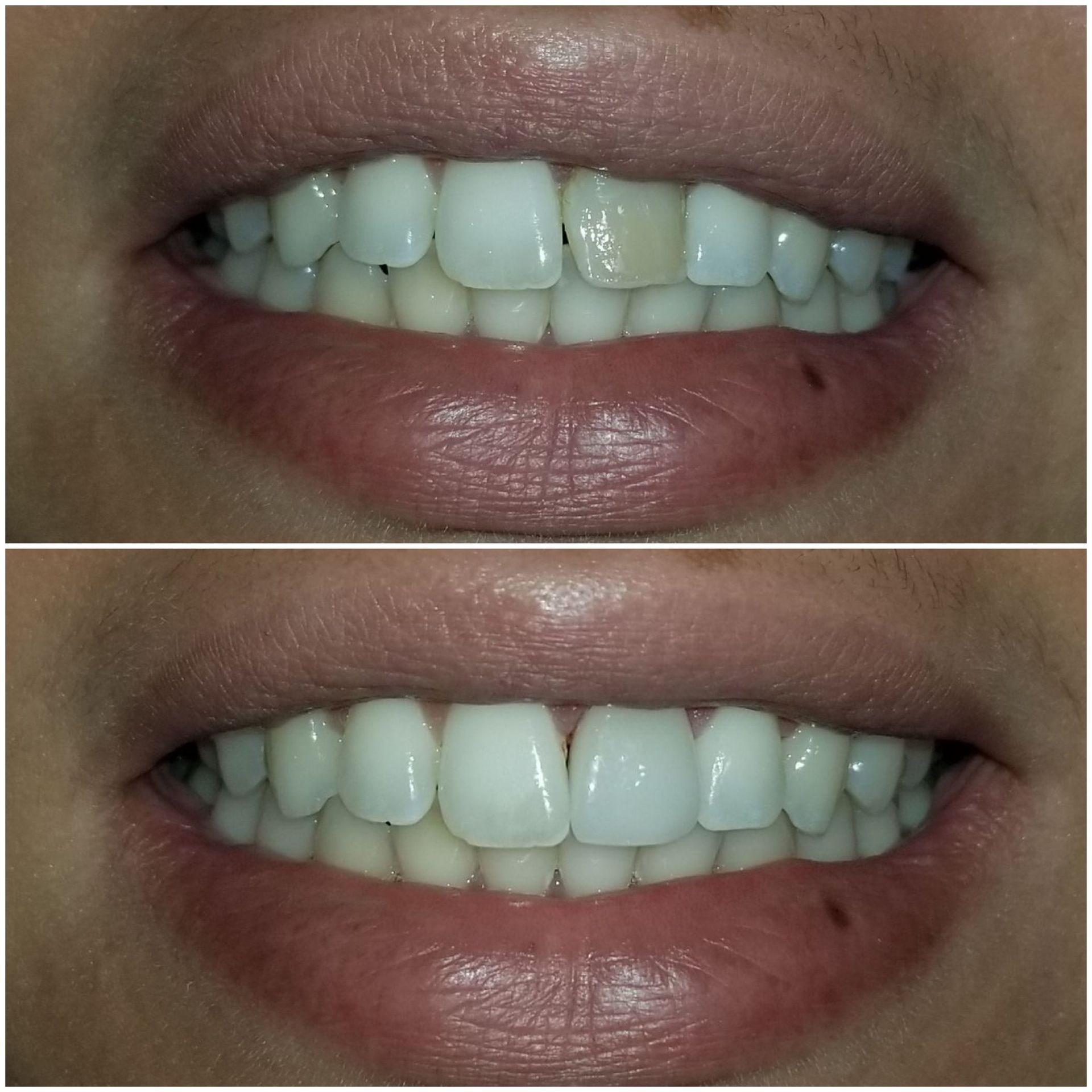 Smiles Gallery | WOW Dental | Detroit, Michigan