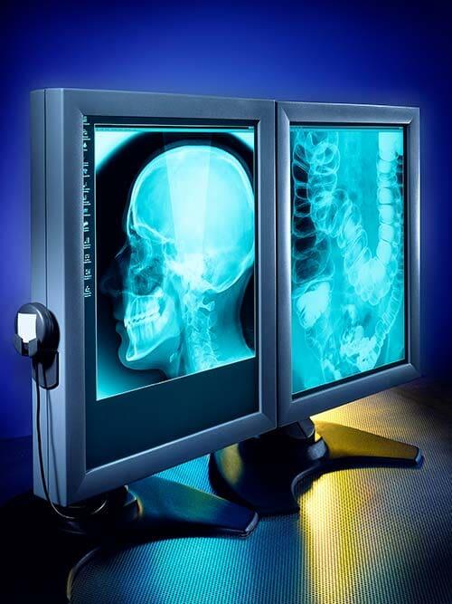 Laboratorio de análisis clínicos en Xalapa - Radiología e Imagen