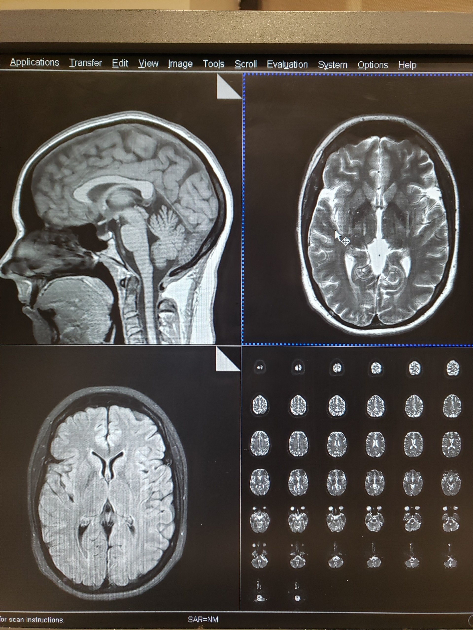 Imaging Diversified in the Media | Fairburn, GA | Imaging Diversified