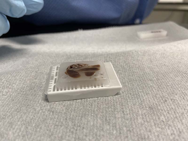 Pathology Services | NovoVita Histopath Laboratory