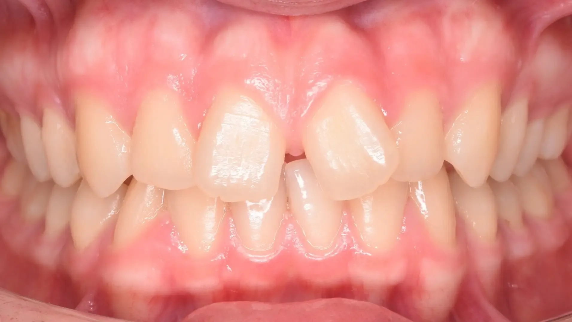 Smile Gallery | Olliver Orthodontics | Blenheim, Marlborough, NZ