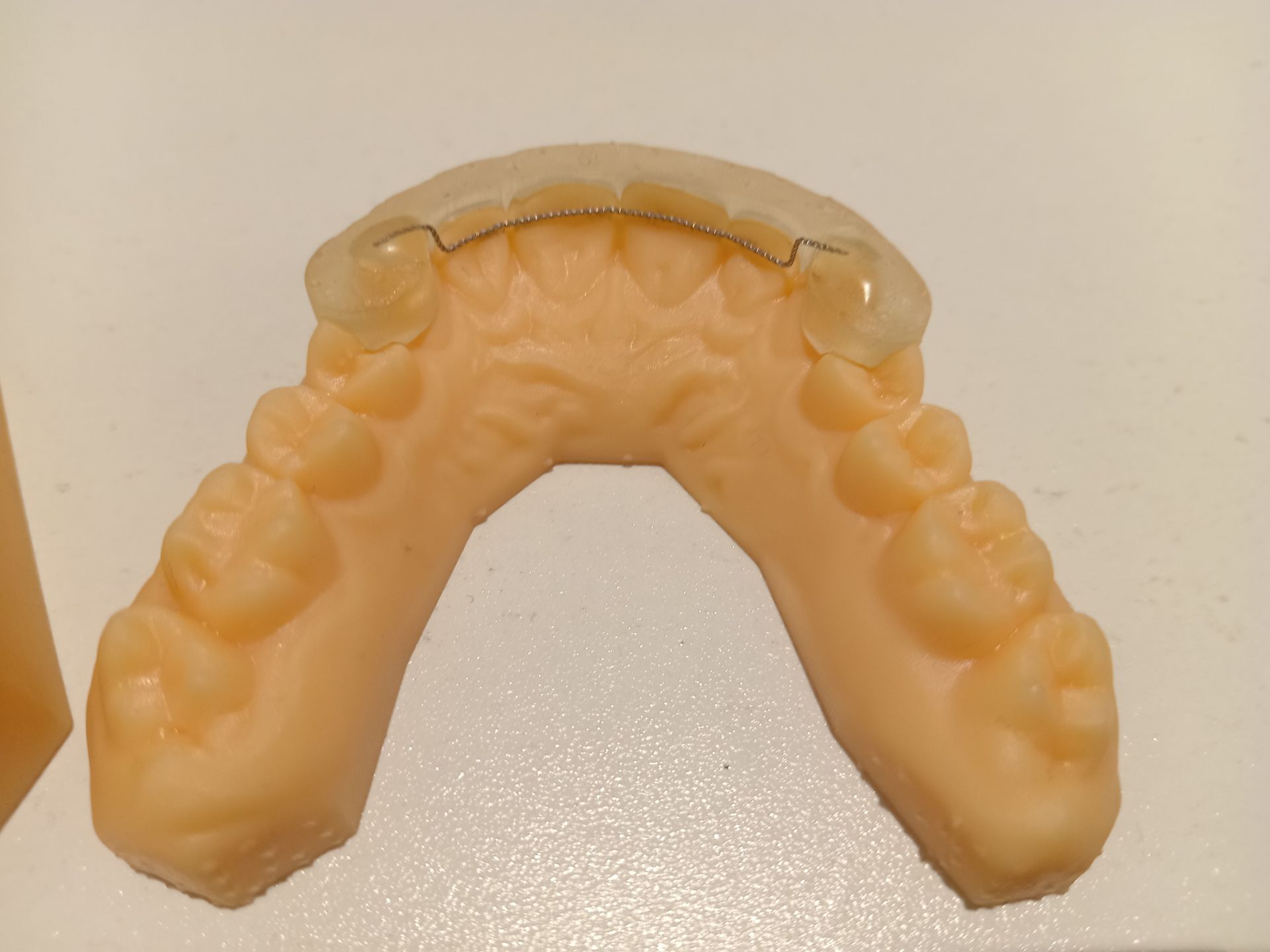 ProviDental Laboratories - clear aligners; retainers; 3D
