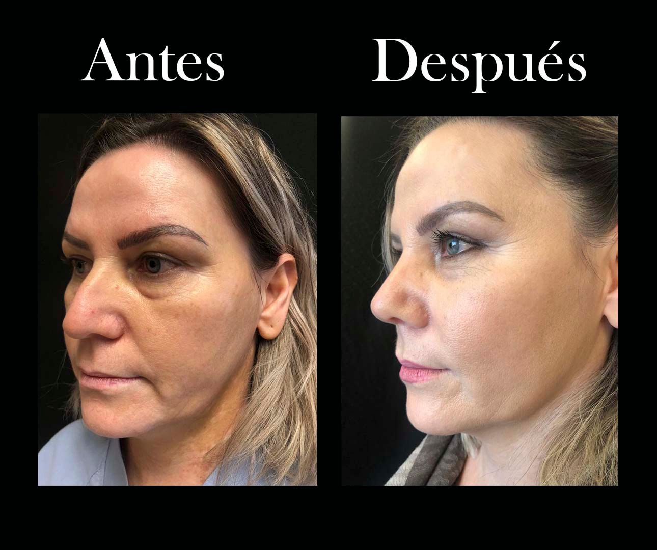 Plastic Surgeon in Mexico | Galvan Plastic Surgery Institute