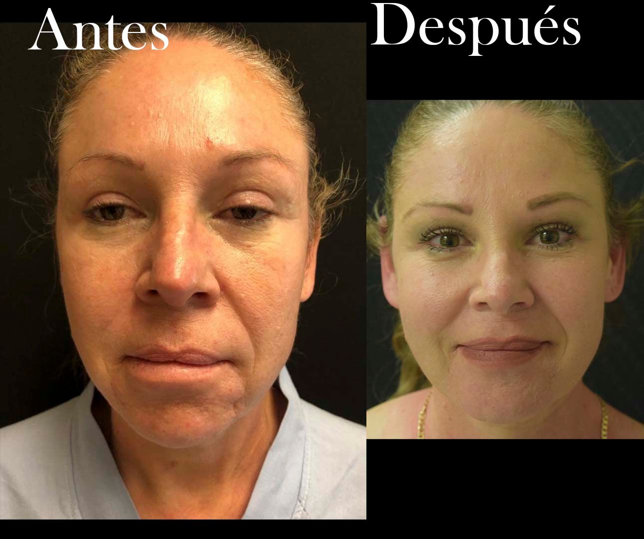 Plastic Surgeon in Mexico | Galvan Plastic Surgery Institute