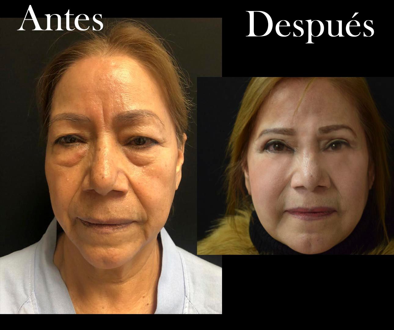 Plastic Surgeon in Mexico | Galvan Plastic Surgery Institute