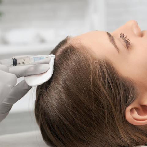 Hair Restoration with PRP + ACell