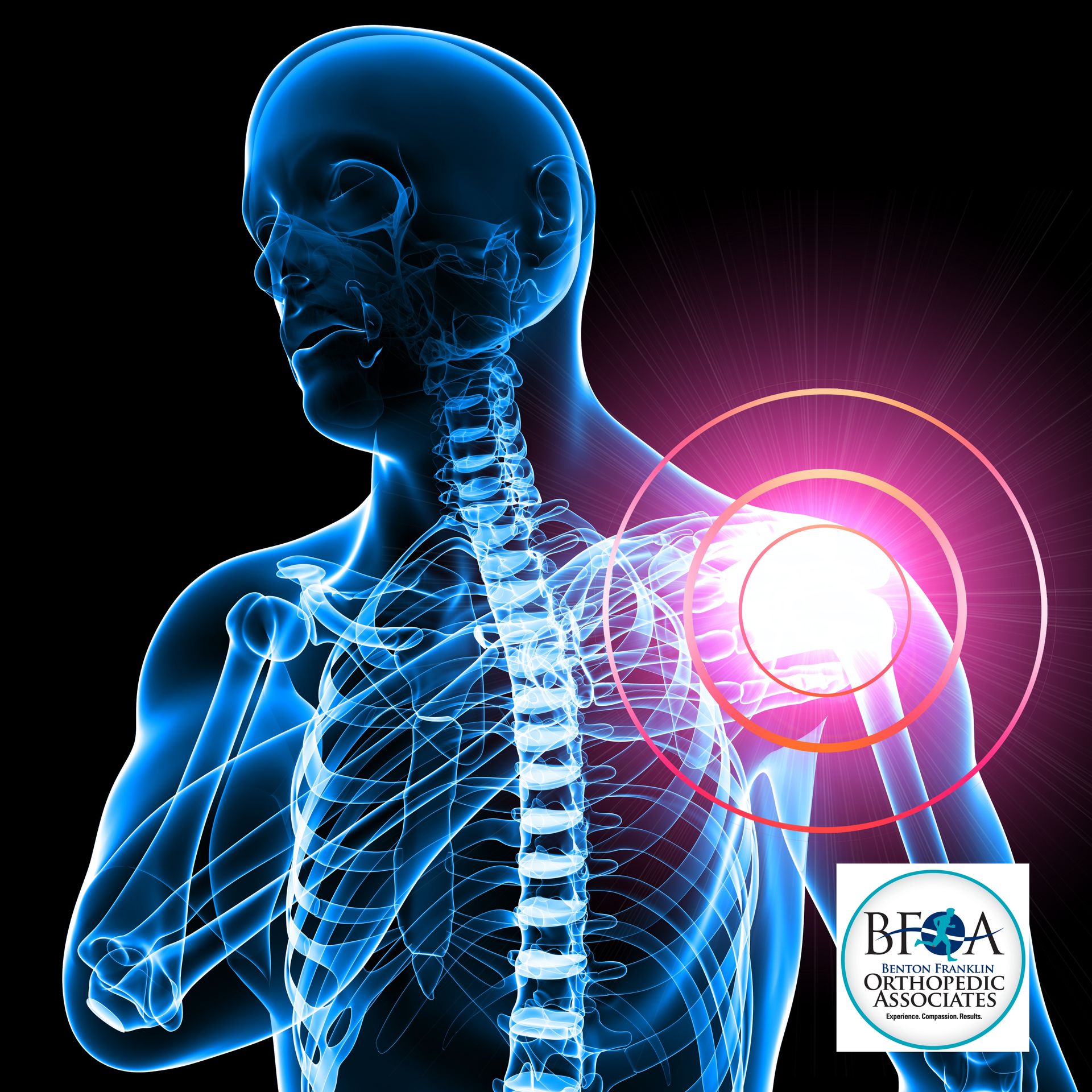 Shoulder Surgery in Kennewick, WA