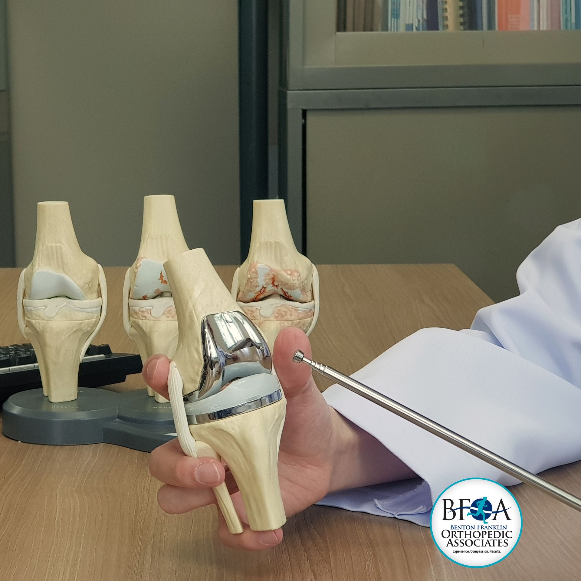 Total Knee Replacement in Kennewick, WA