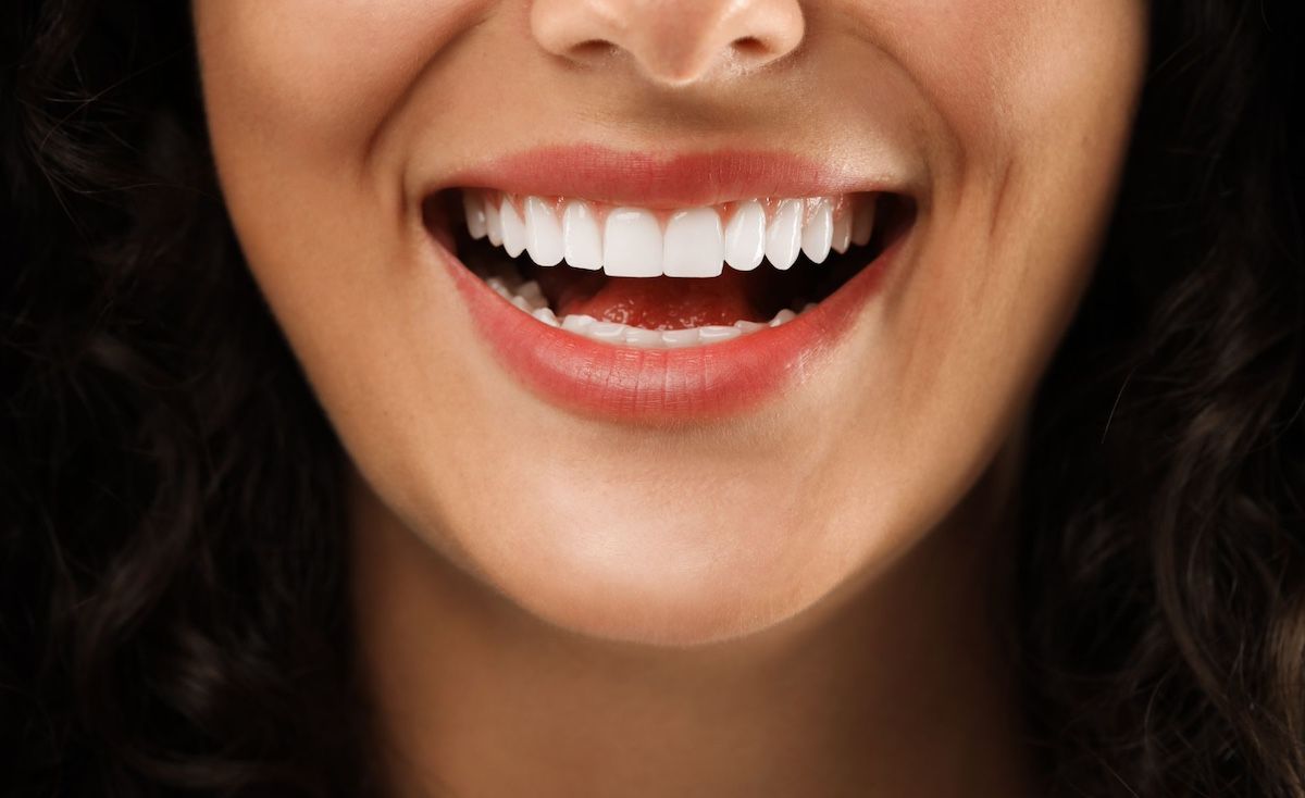 How Much Is KöR Whitening? Everything You Need to Know About the Cost