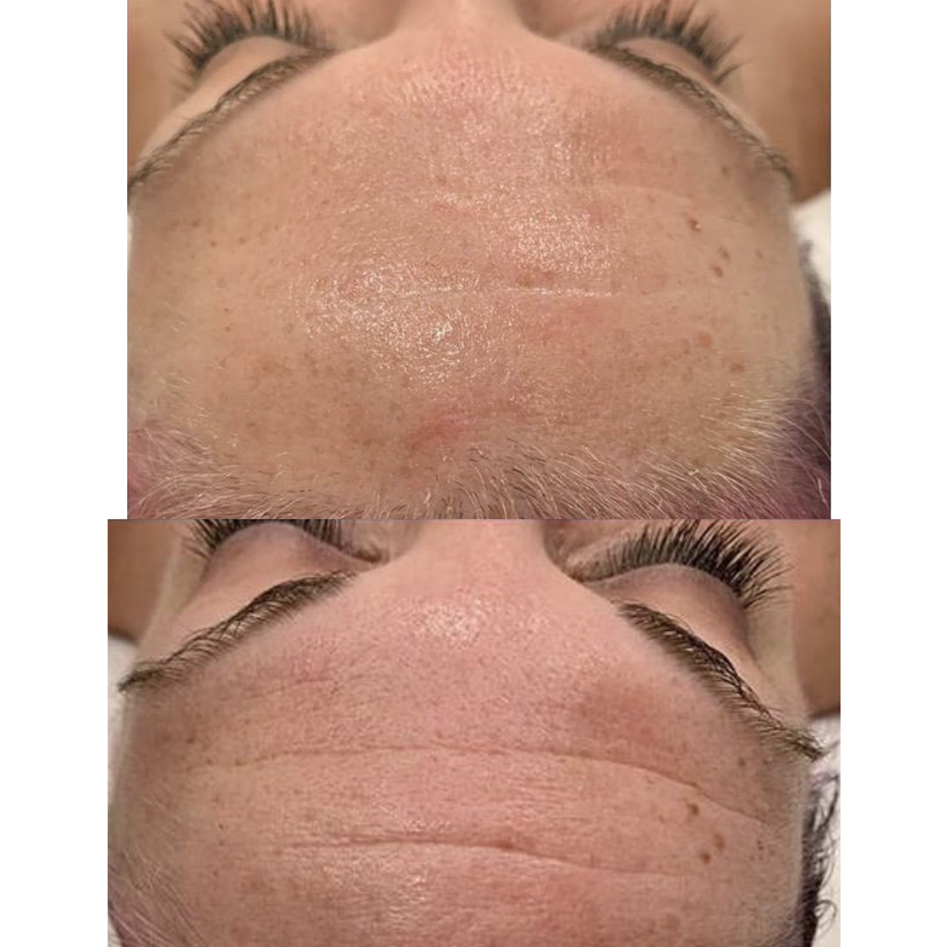 Before & After | Advanced Microcurrent Science for Anti-Aging