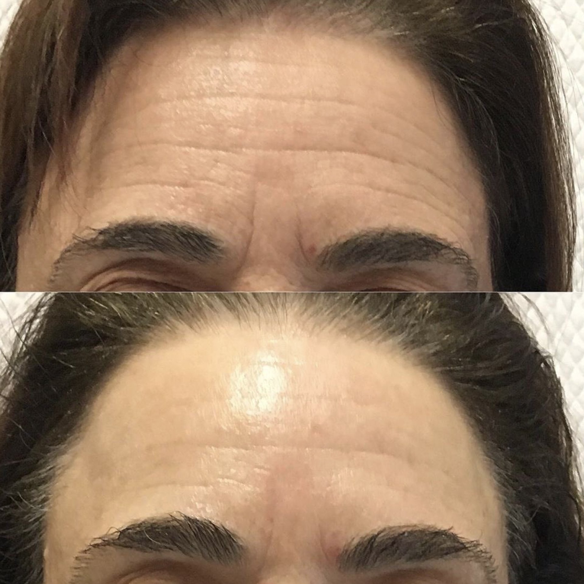 Before & After | Advanced Microcurrent Science for Anti-Aging