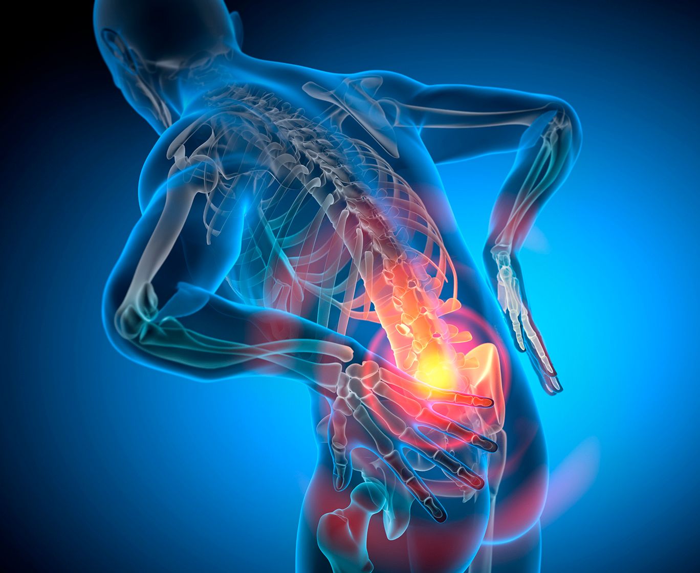 ¿Qué es la lumbalgia?