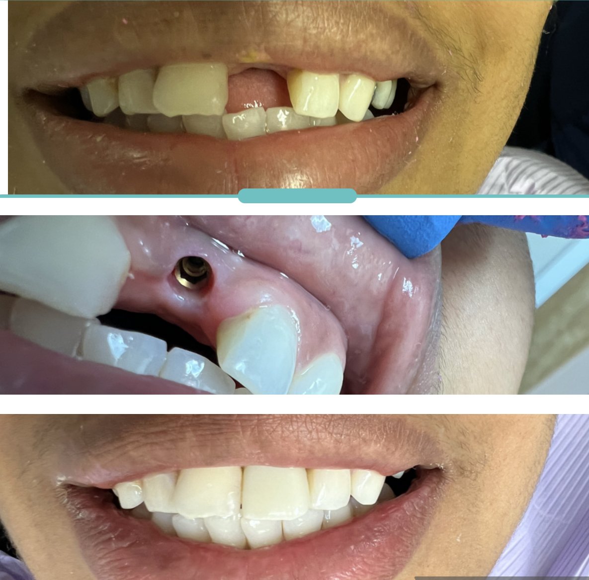 Royal Dental Before and Afters | Our Work