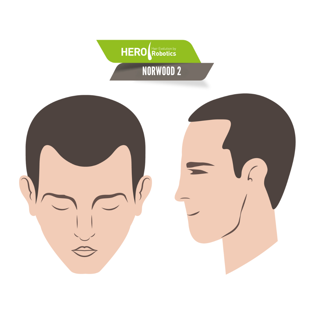 Hair Transplant Colombia | HERO Institute
