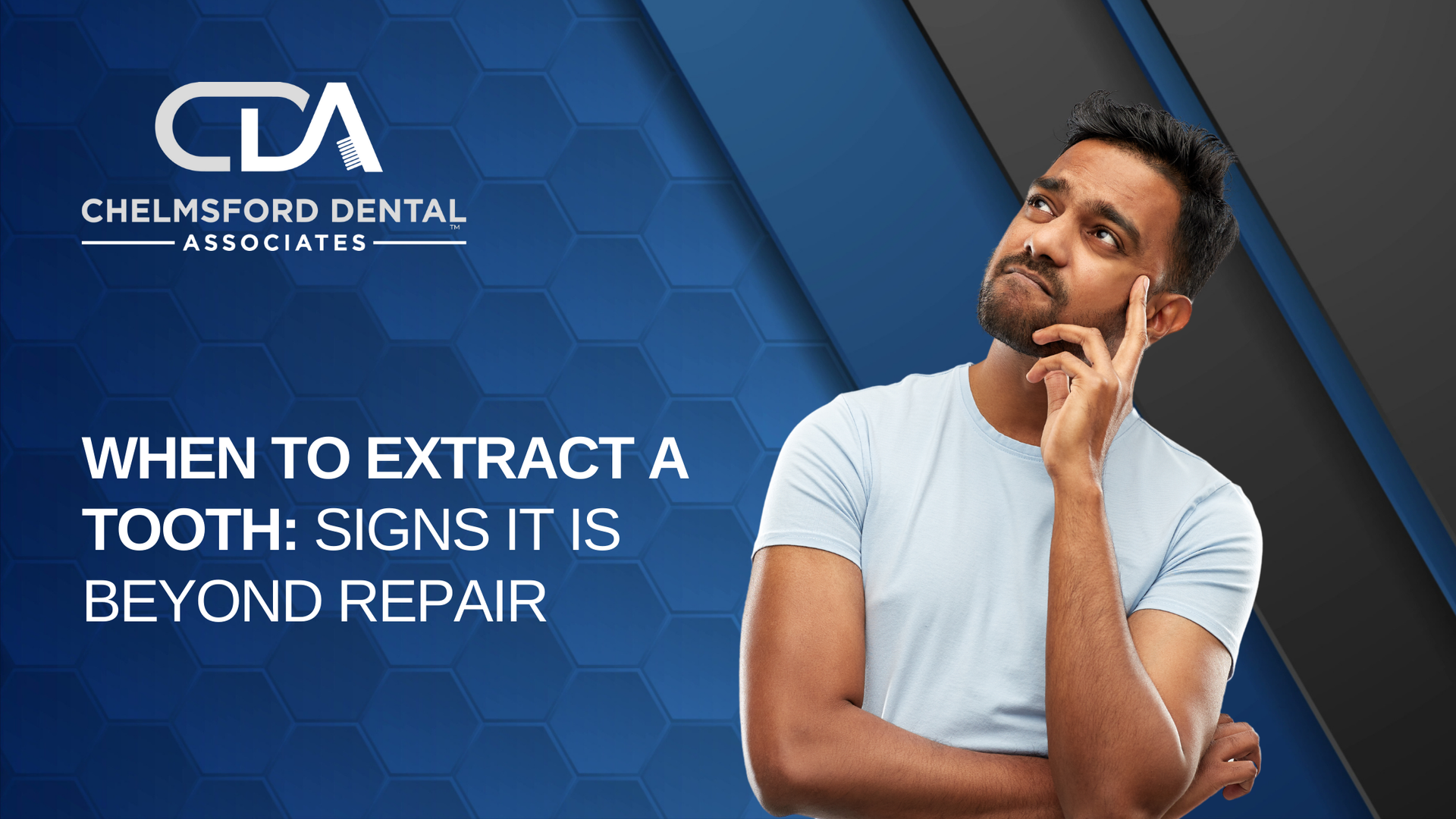 When to Extract a Tooth: Signs It Is Beyond Repair