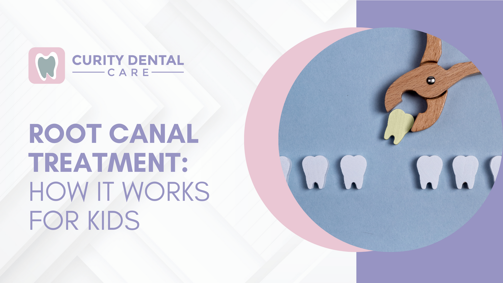 Root Canal Treatment: How It Works for Kids