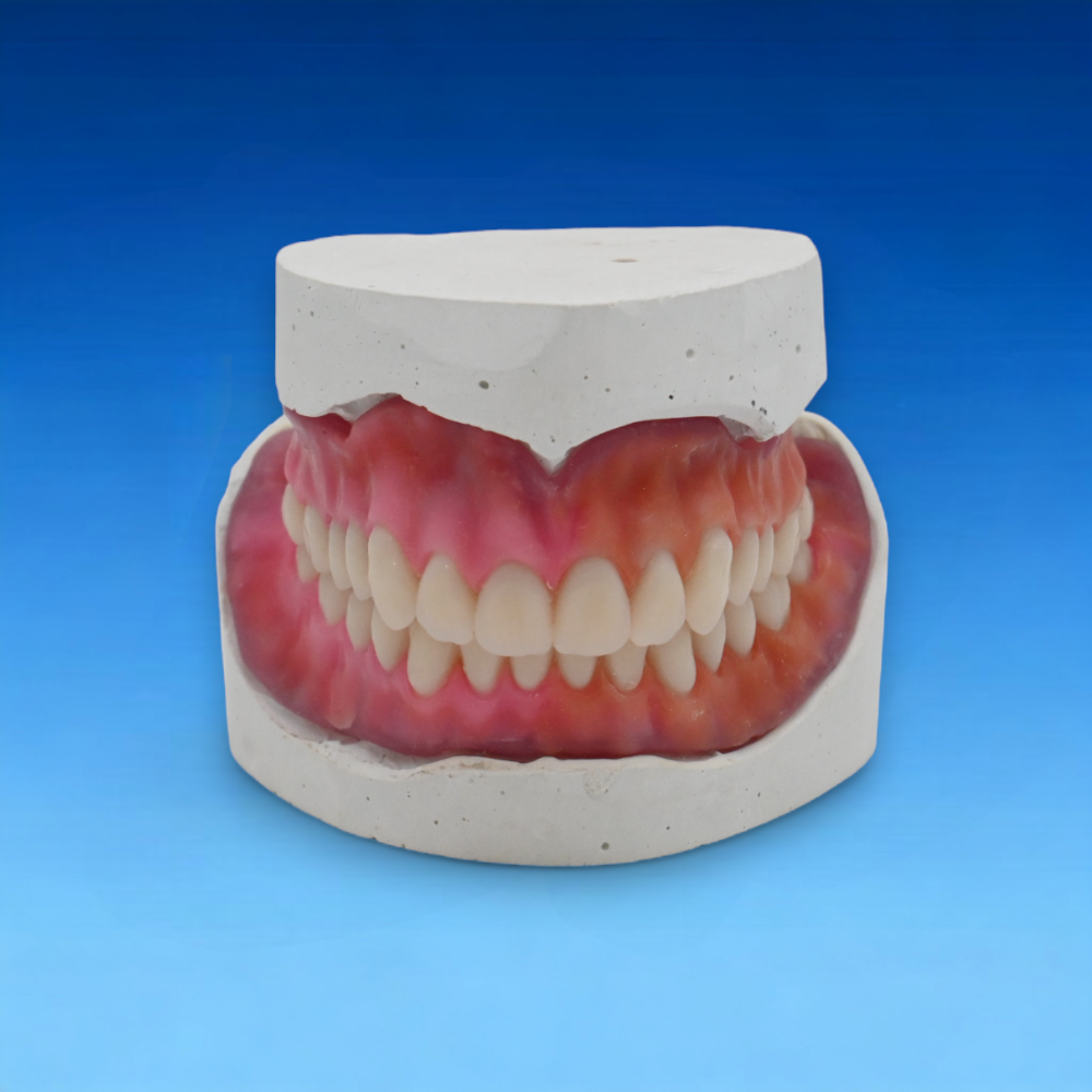 Premium Denture | Summit-Horizon Dental Lab