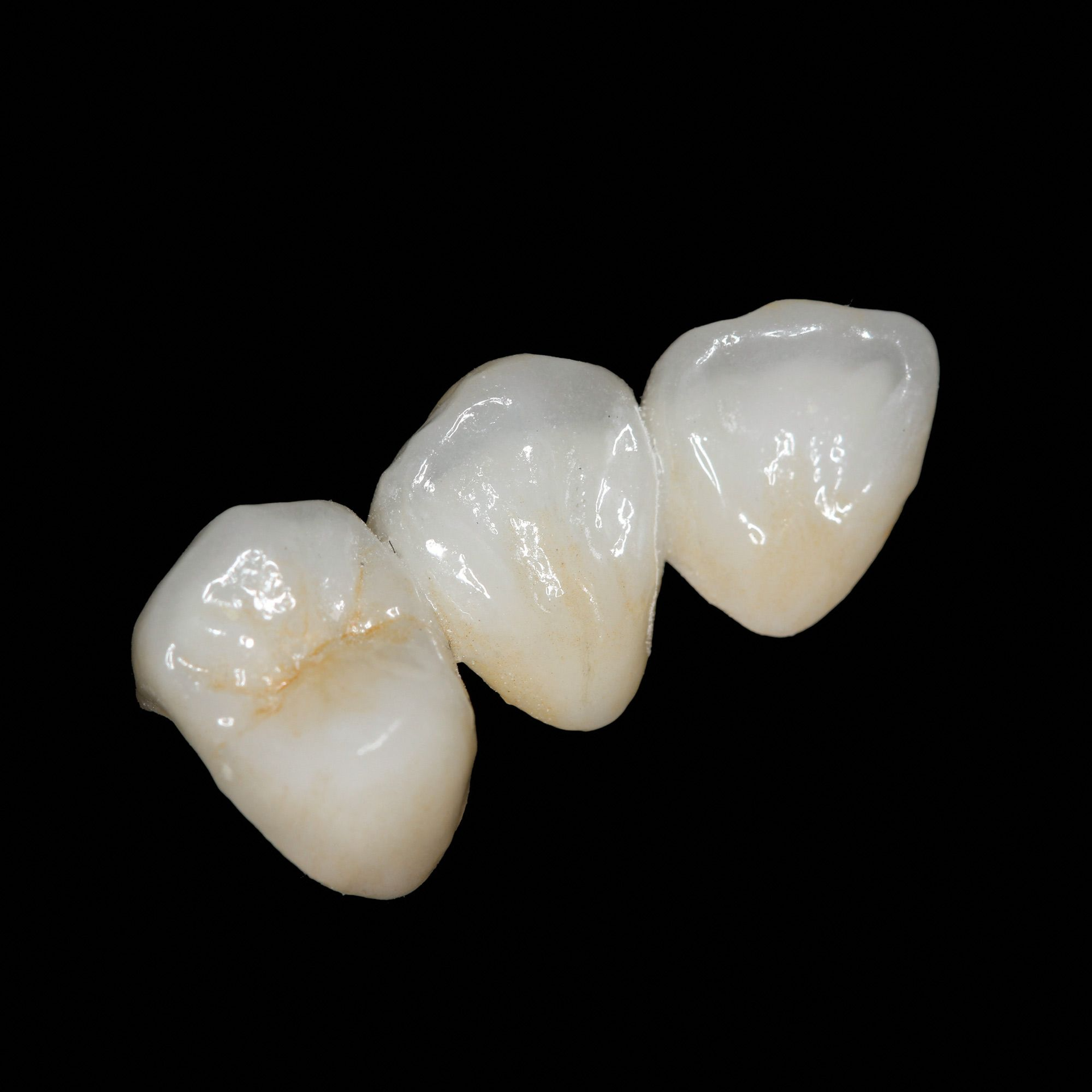 Zirconia Crowns & Bridges | CAD/CAM Dental Lab Fabrication