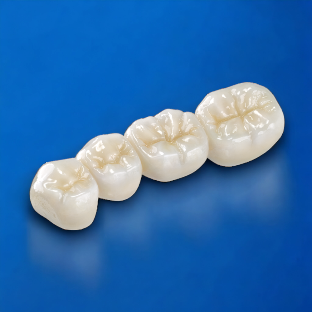 Full Contour Zirconia Crowns for Dentists Nationwide | Summit-Horizon ...