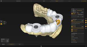 Innovative Dental Technology | Summit-Horizon