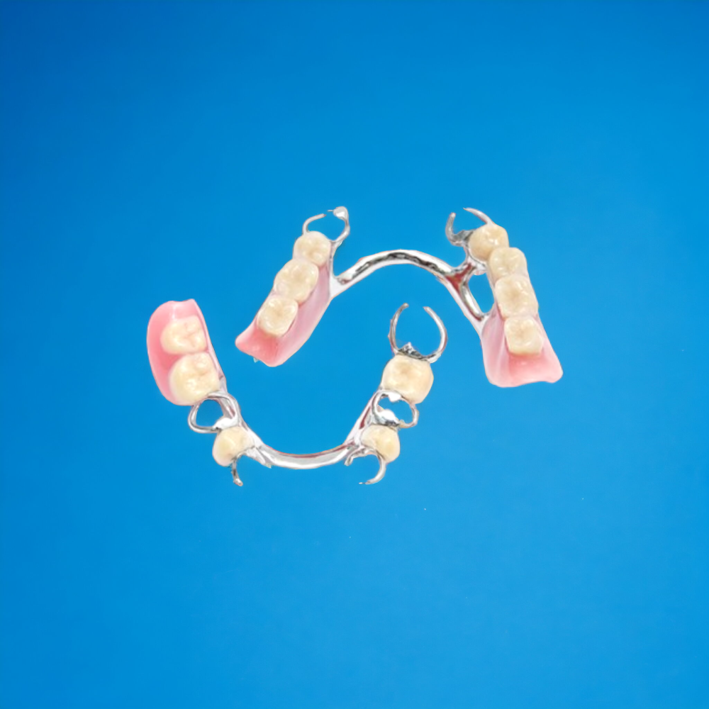 Metal Framework Partials - Summit-Horizon Dental Lab