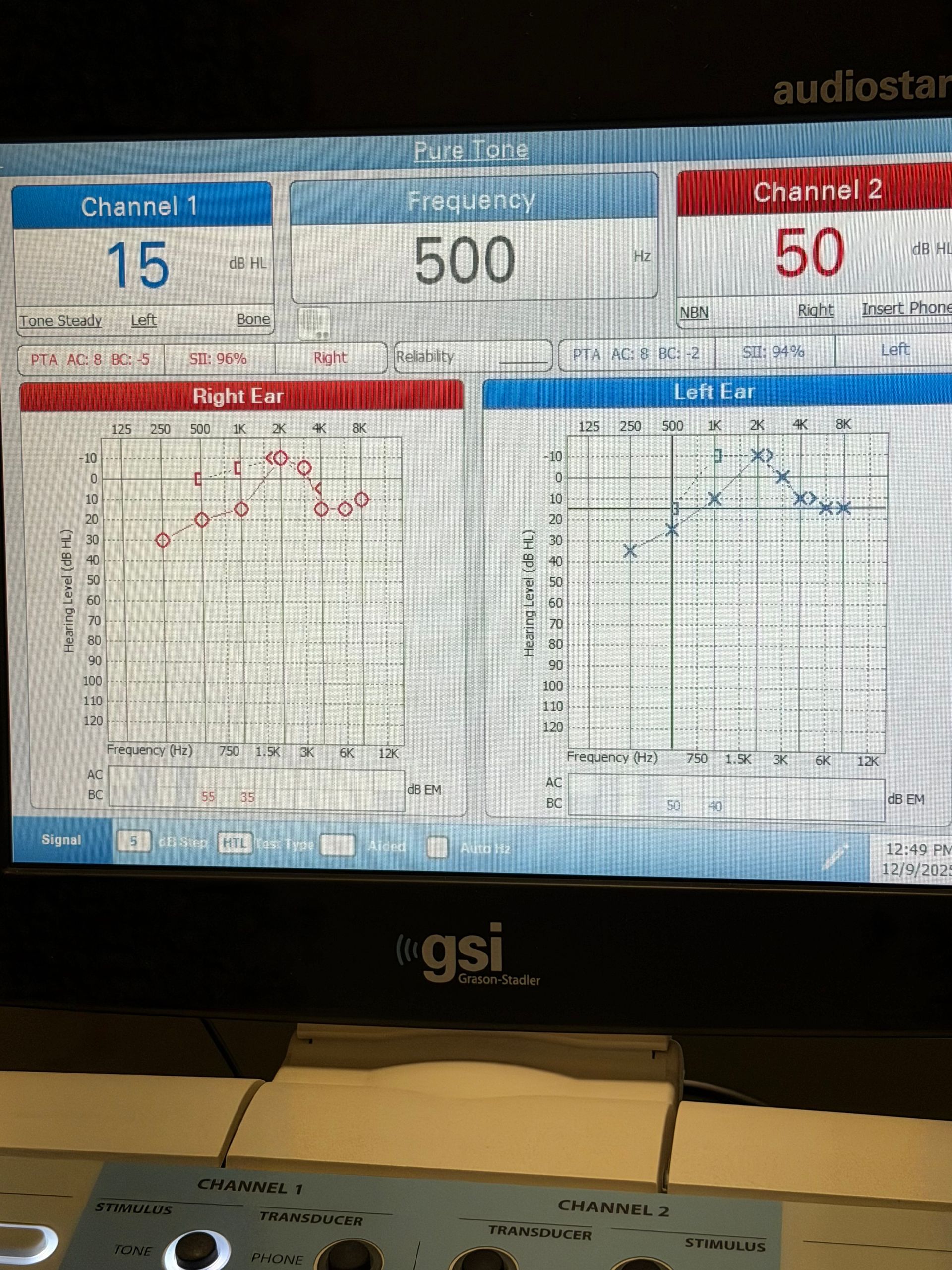 Inside a Hearing Test: What Really Happens at Your Appointment