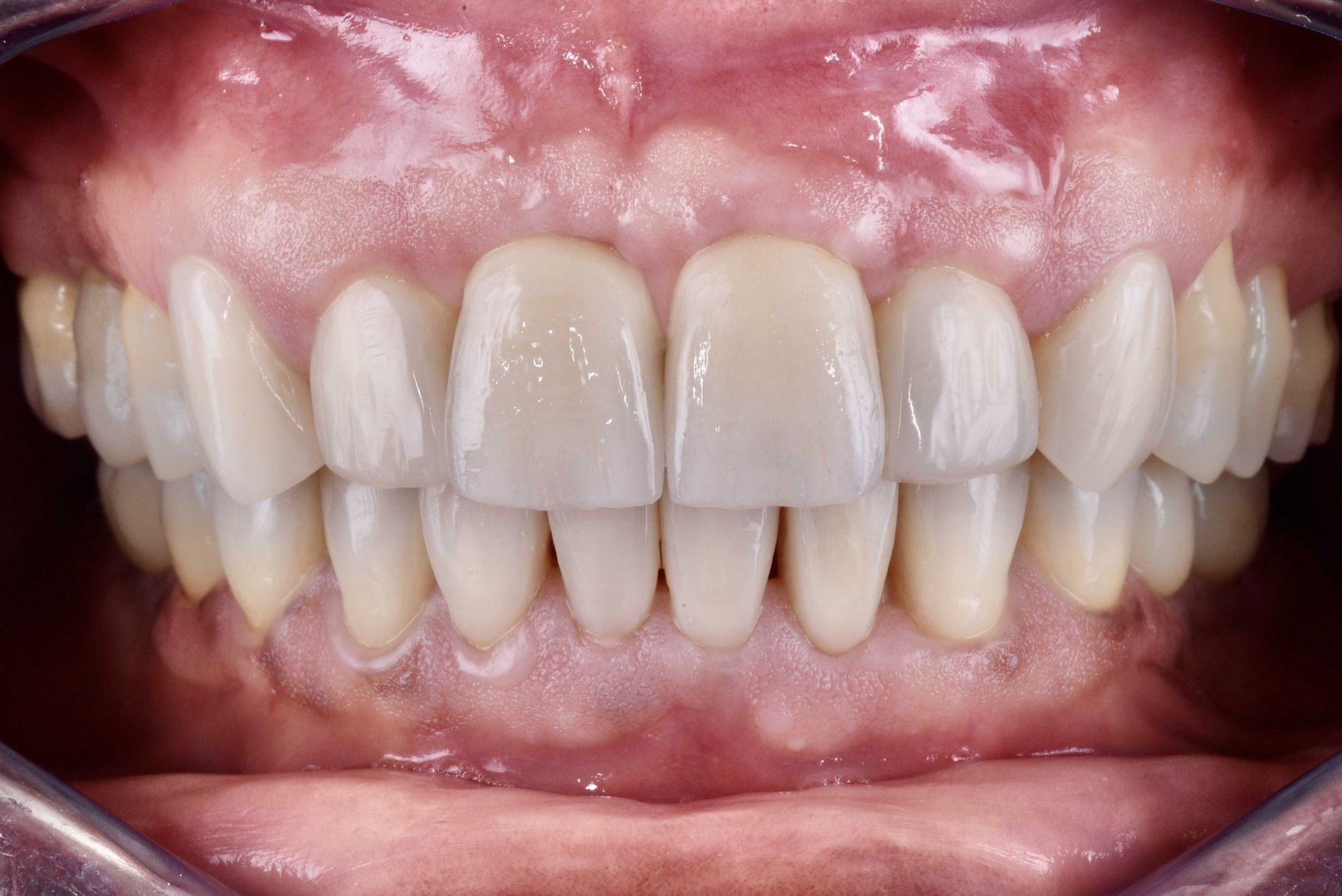 Geneva Smile Center - Nos traitements