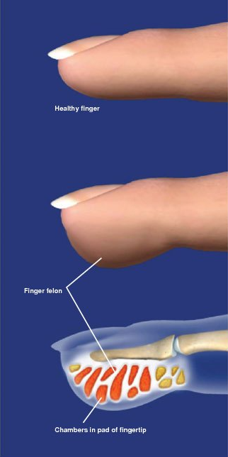 Archway Orthopedics