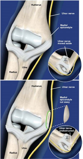 Archway Orthopedics