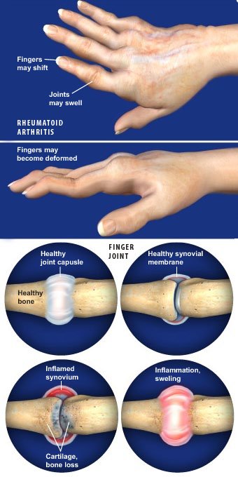 Hand Conditions