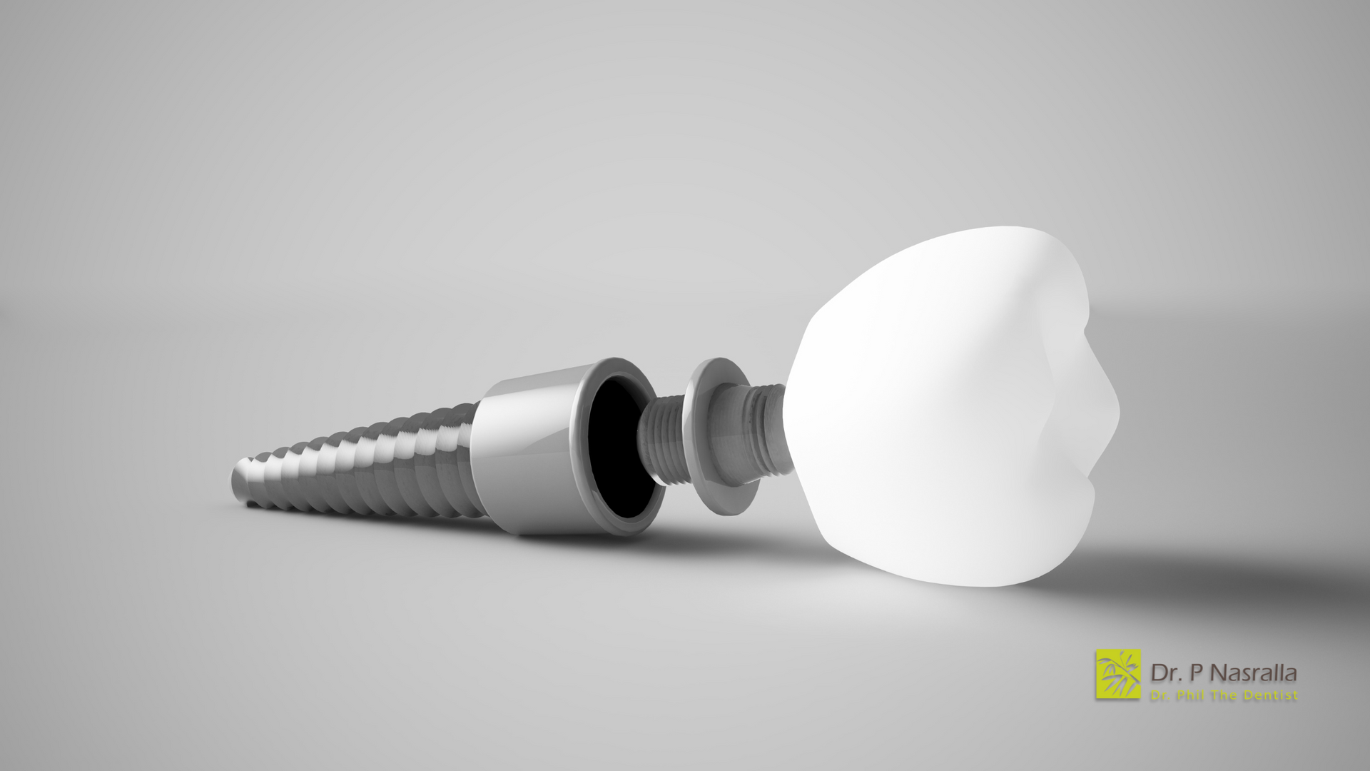 Comprehensive Care for Peri-Implantitis: What You Need to Know
